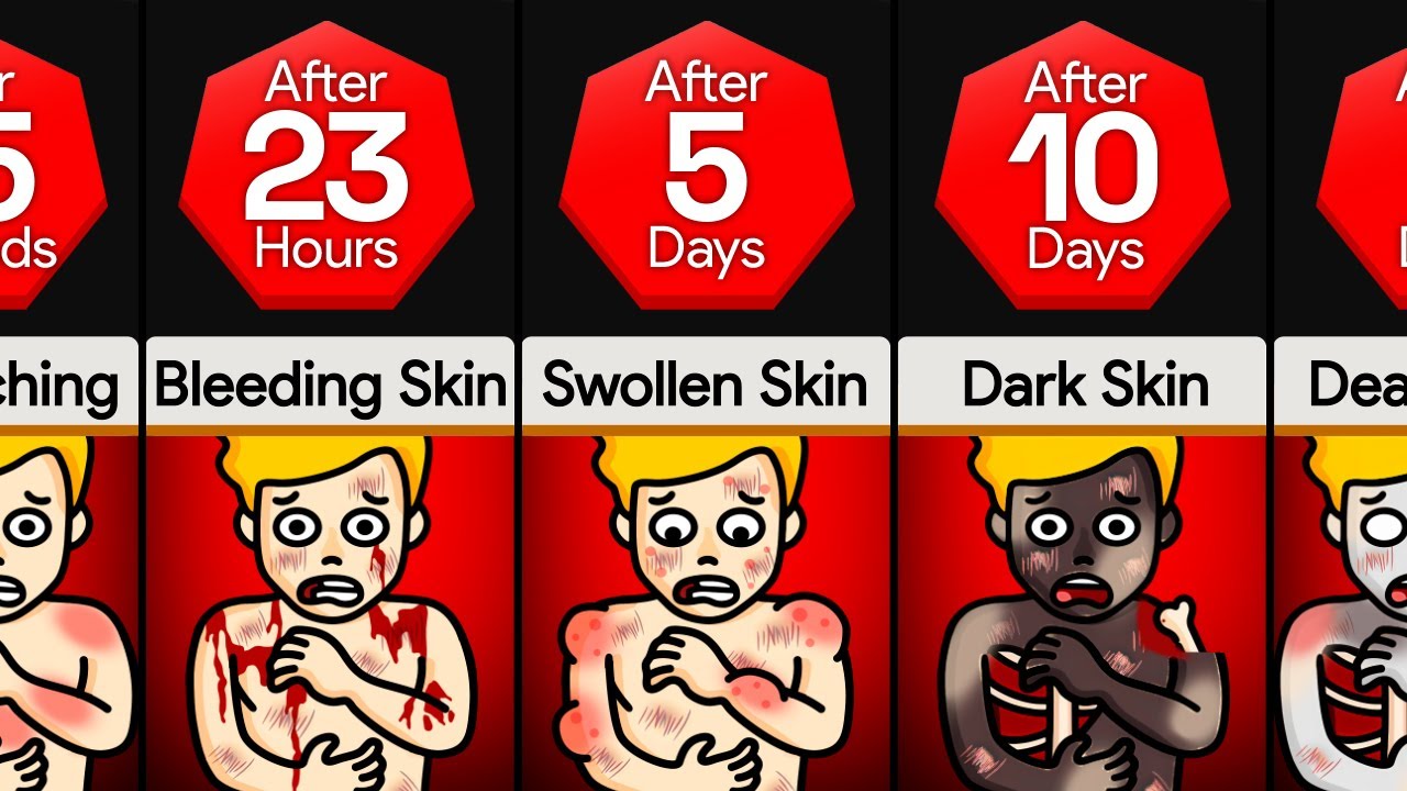 Timeline: What If You Keep Scratching Yourself Nonstop - YouTube