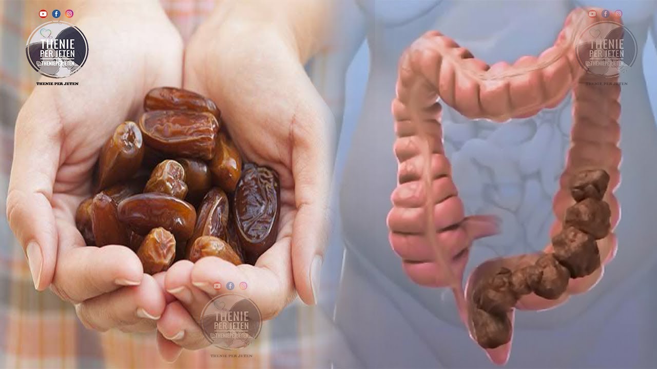Duke konsumuar hurma Arab per 15 dit do të trajtonit një nga problemet ...