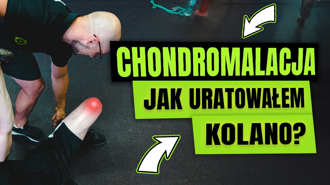 CHONDROMALACJA RZEPKI I KŁYKCI PISZCZELOWYCH- moja historia - YouTube