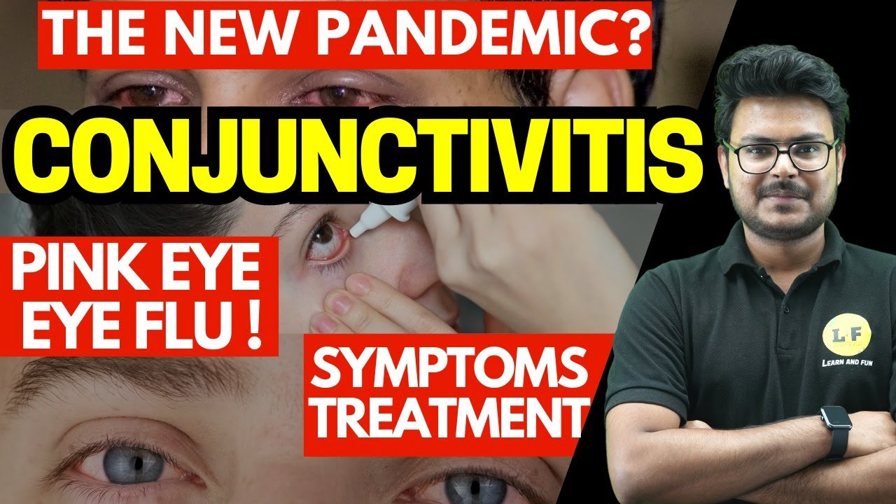 Eye Flu: Kaise Hota Hai ??? | Pink Eye | Conjunctivitis Symptoms ...
