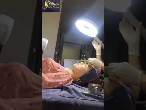 Điều trị mụn chăm sóc da cho chị gái xinh đẹp cười tươi như hoa