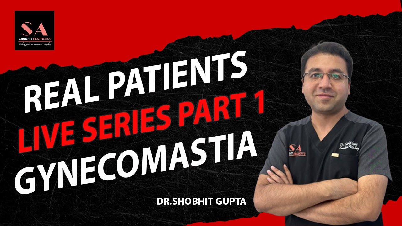 Real Patients Live Series Part 1 Gynecomastia - Gynecomastia Surgery ...