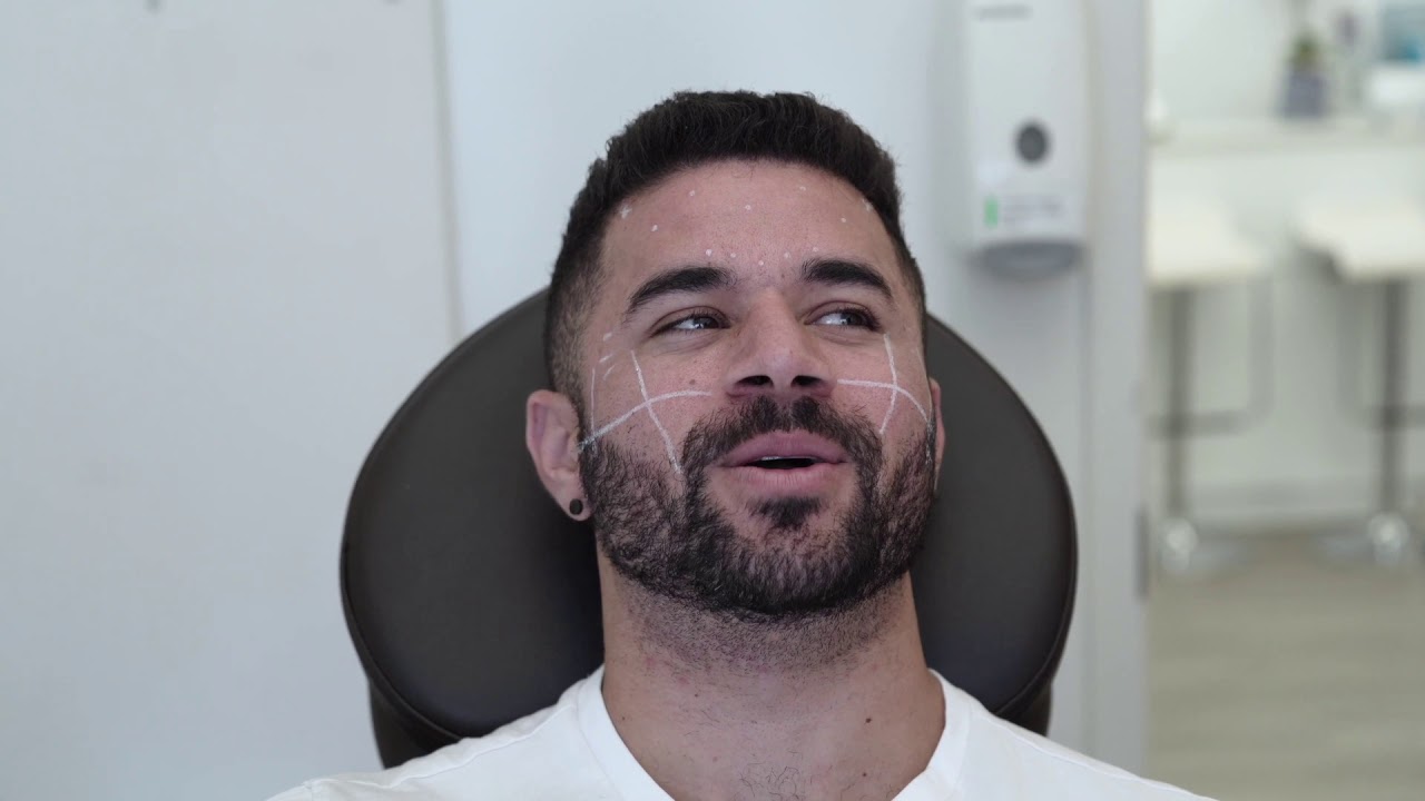 Botox and Fillers for Guys - First Patient Experience - Real Story ...