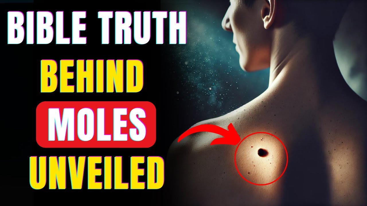 Could Your Moles And Birthmarks Be Linked to a Biblical SECRET? What Is ...