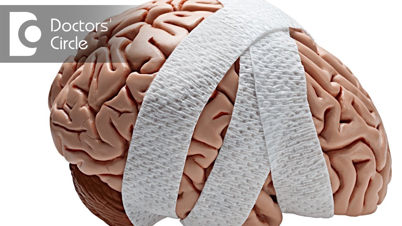 Does minor hitting of head cause persistent dizziness - Dr ...