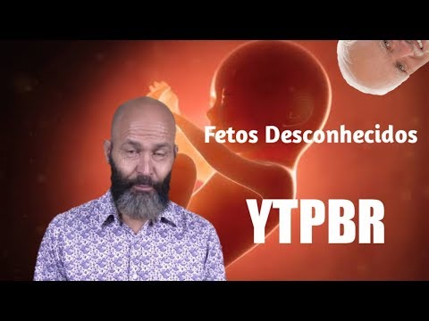 YTPBR-Fetos Desconhecidos, Antonio Boquete sem boquete
