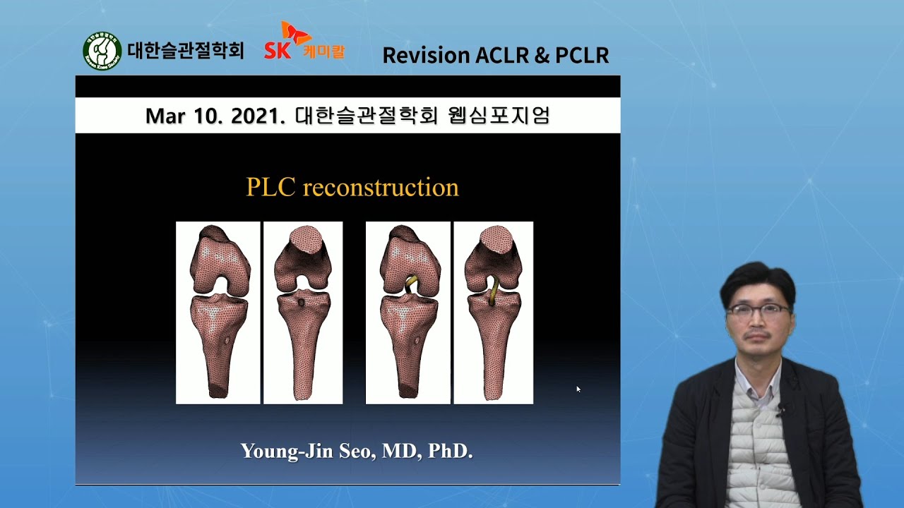 대한슬관절학회 - PLC reconstruction - 서영진 교수 - YouTube