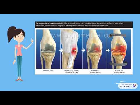 CoActivation muscle - YouTube