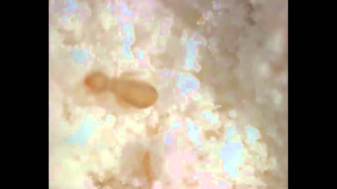 Book louse - YouTube