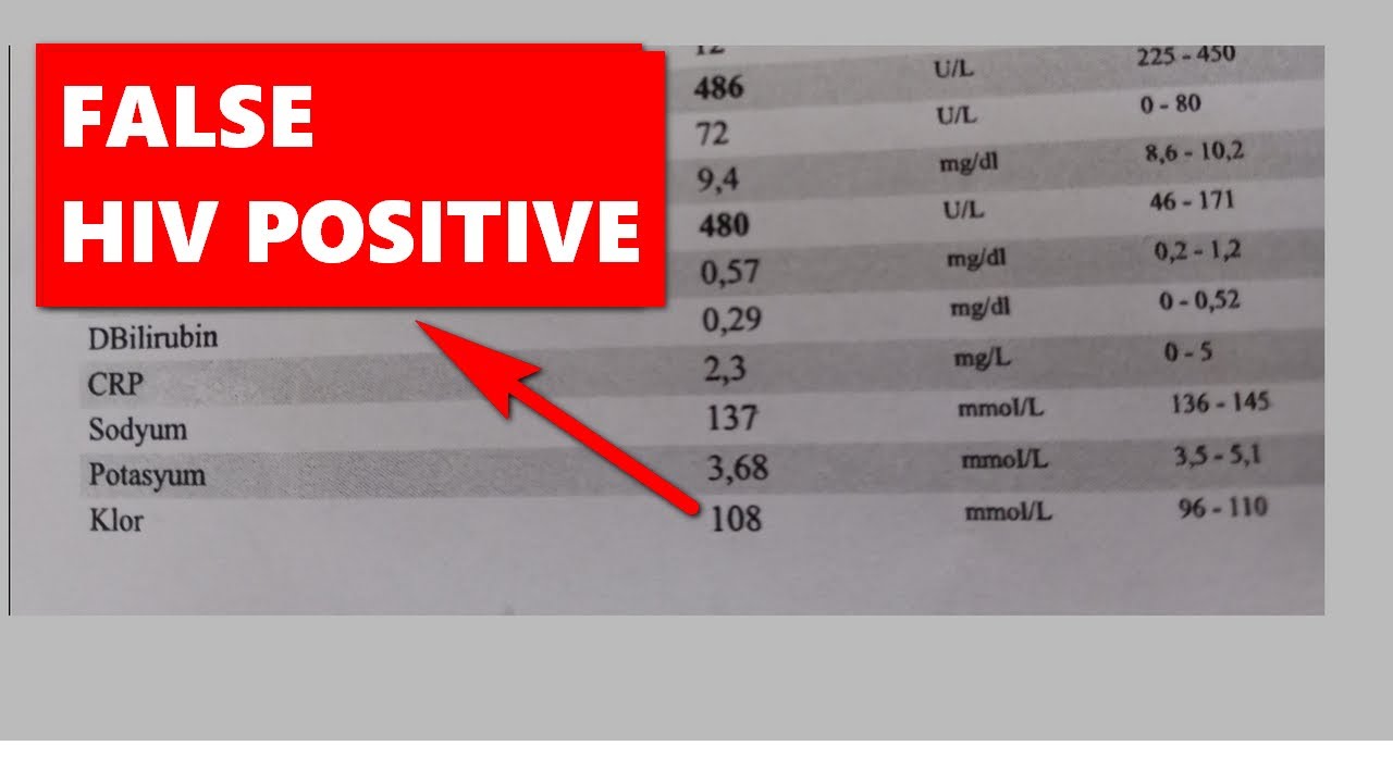 HIV TEST INTERFERENCE! ALL FALSE HIV POSITIVE REASONS! - YouTube