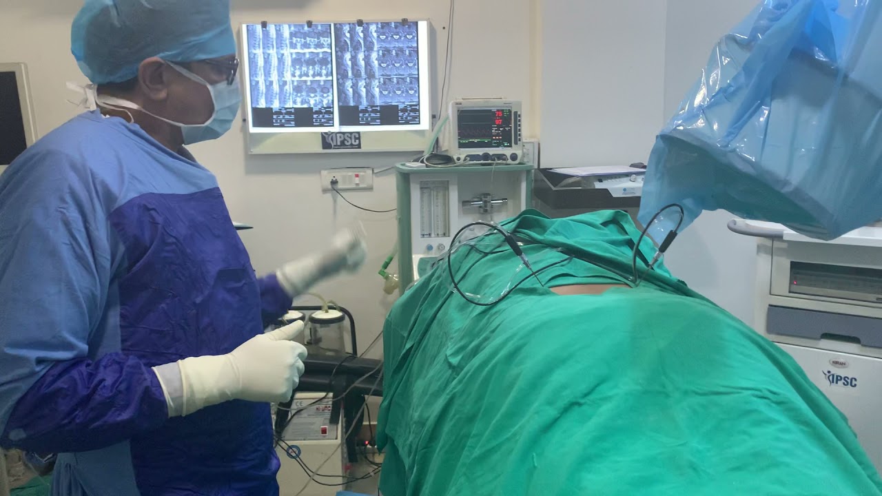Biacuplasty; Disc repair procedure for Discogenic Pain - YouTube