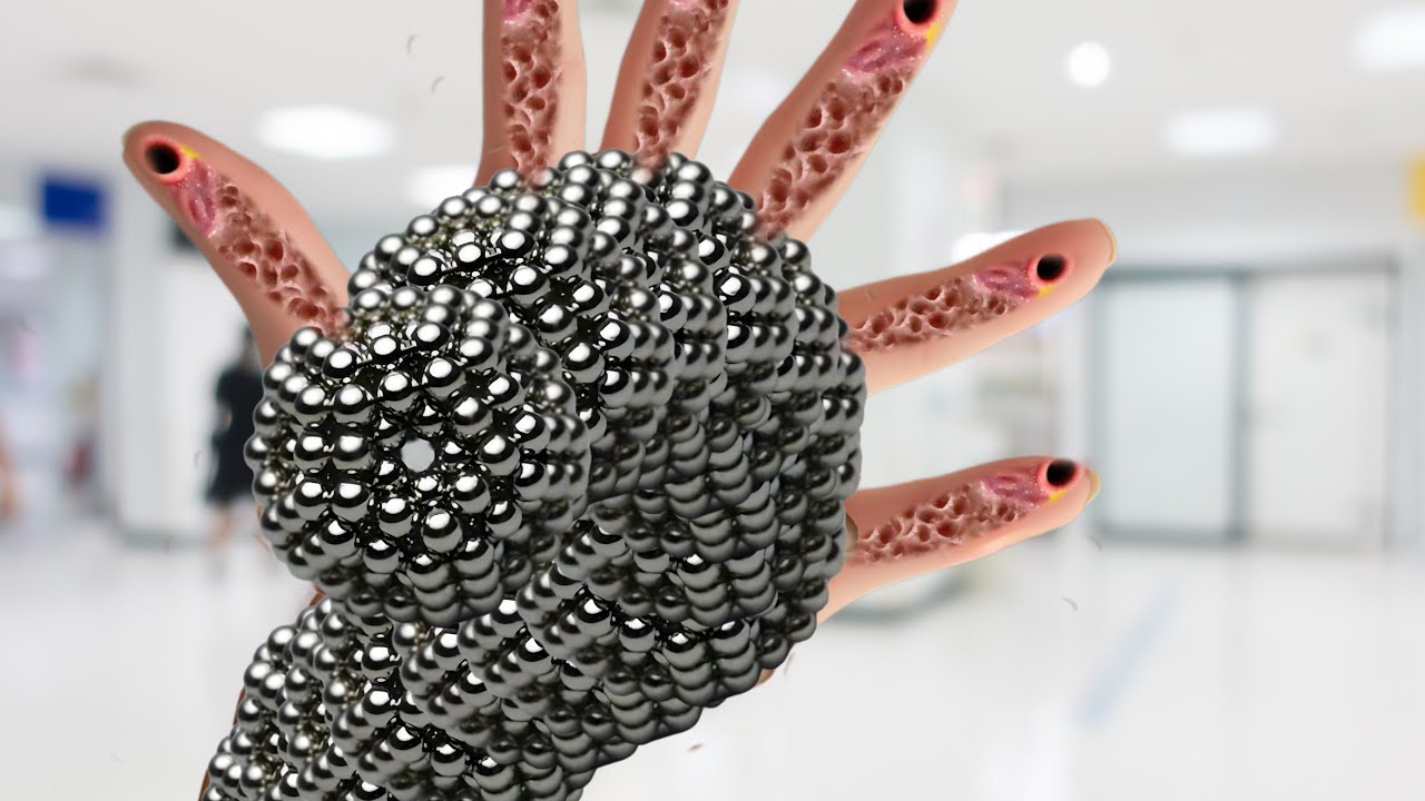 ASMR relax trypophobia maggots happened while treatments Hand|ASMR ...