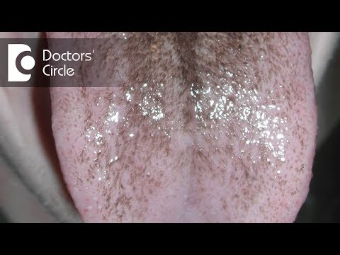 How to remove black spots on tongue? - Dr. Aarthi Shankar