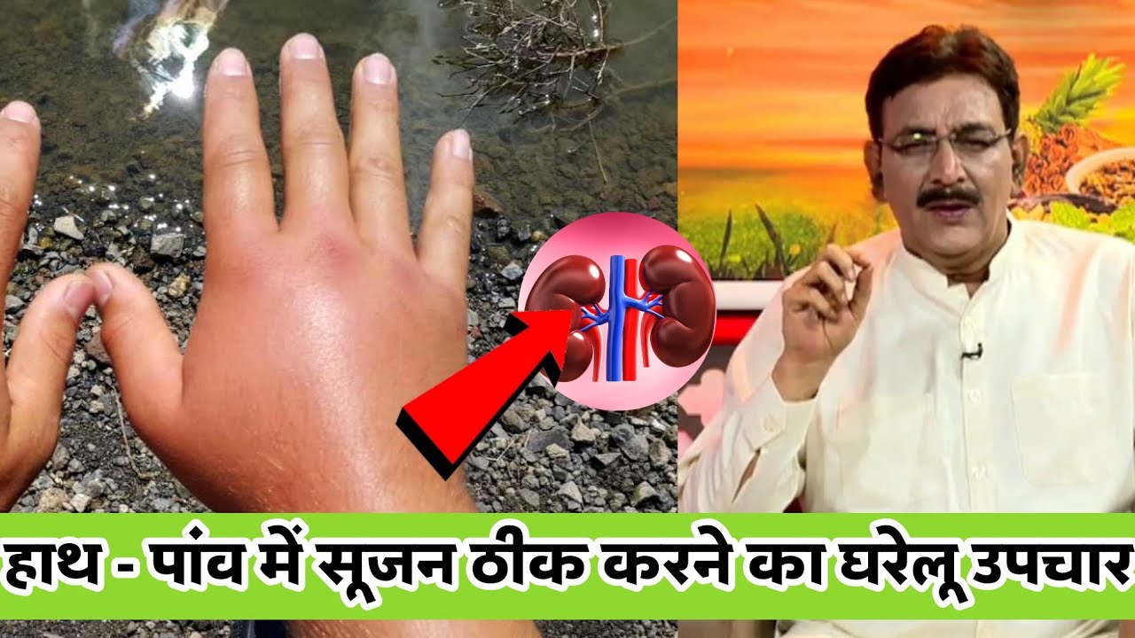 Hath me sujan ko Thik karne ka gharelu Nuskha || By Hakim Suleman Khan ...