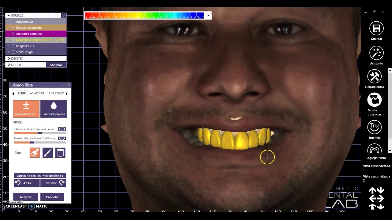 SCANNER FACIAL FROM PLANMECA (PROFACE) IN EXOCAD - YouTube