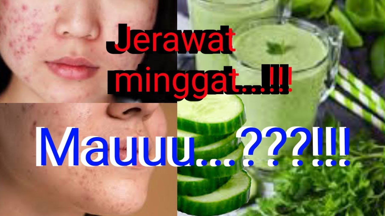 Tips atau cara mengobati jerawat dengan bahan alami, mudah, ampuh dan ...