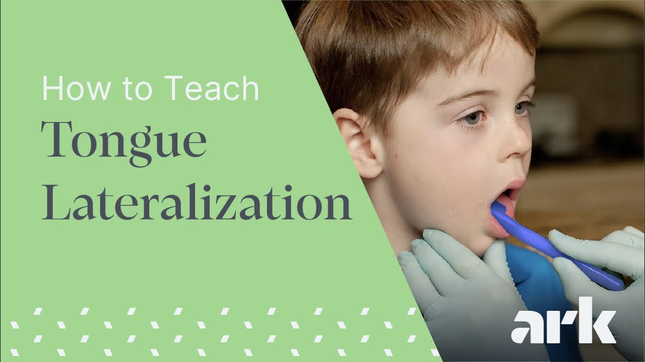 Improve Tongue Lateralization with ARK's Oro-Navigator™ - YouTube