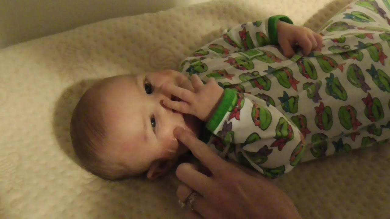 NAM DEVICE CLEFT LIP/PALATE - YouTube