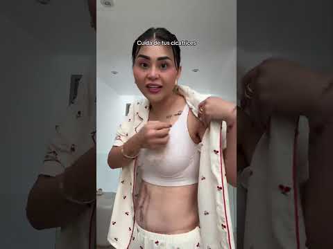 Cinta de cicatrices 🤍✨ #gomita #shorts