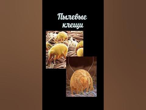 Пылевые клещи /Чем они опасны? Профилактика против полевых клещей # ...