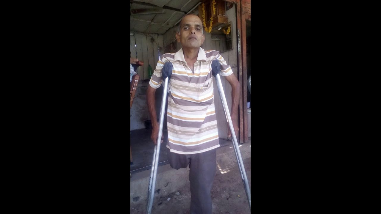 This man lost a leg because he couldn't afford to treat infection ...