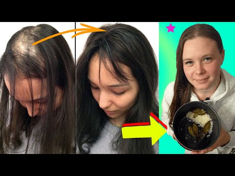 Этот Секрет не оглашают! Отрастить волосы и лечить облысение с первой недели легко!Домашнее средство