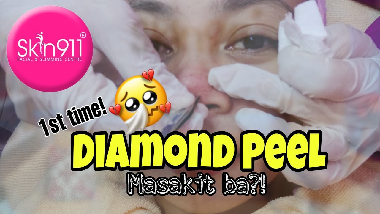 What is Diamond Peel | My First Diamond Peel Experience featuring SKIN ...