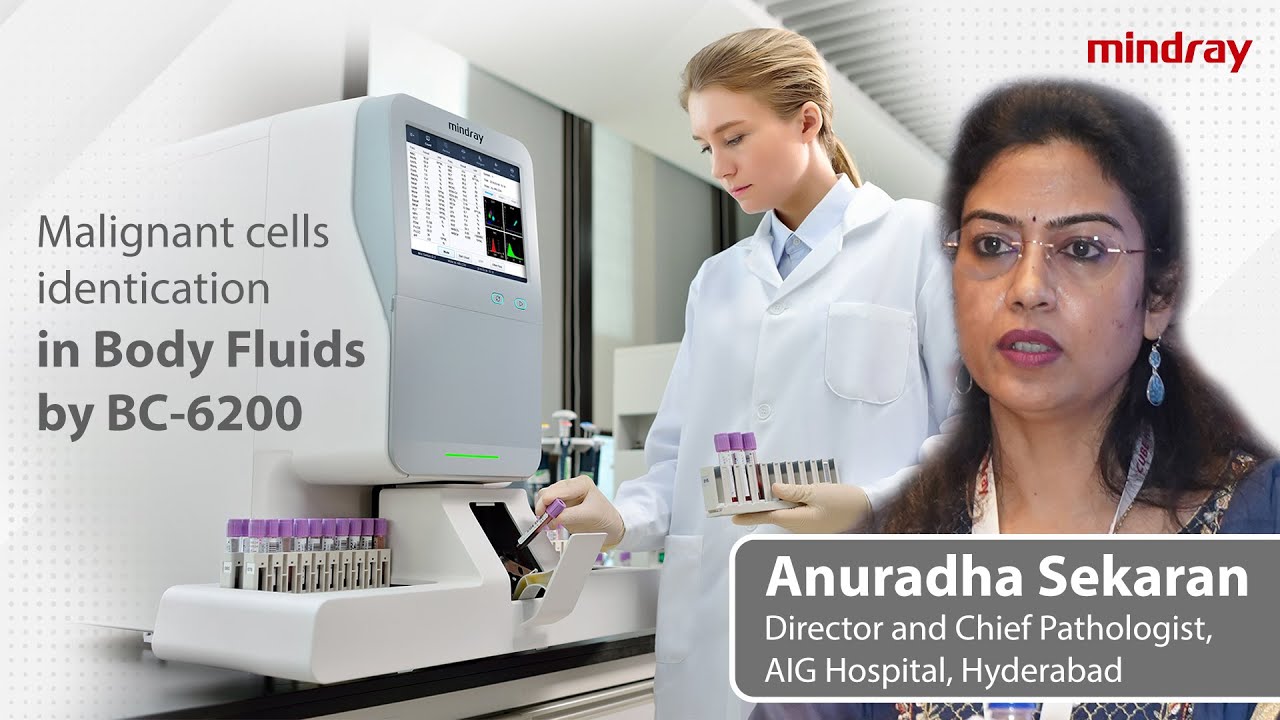 Identification of Malignant Cells in Body Fluids sample with Mindray BC ...
