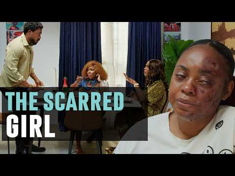 THE SCARRED GIRL | ZOKE SHORTS