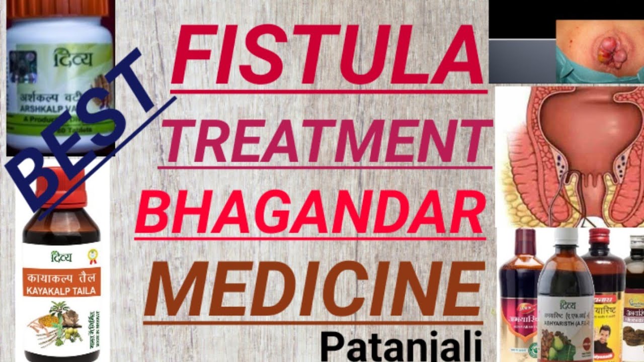 Fistula | Fistula Treatment | Medicine For Fistula | Bhagandar Pain ...
