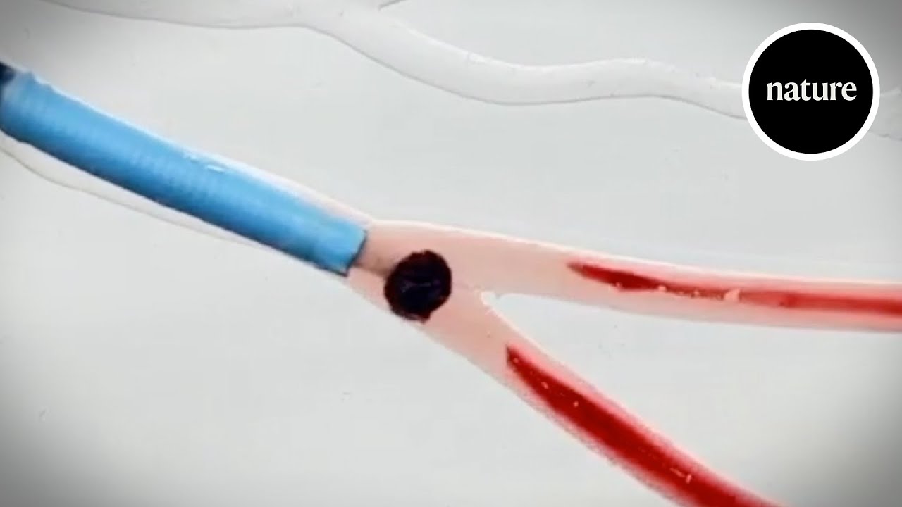 This tiny device spins blood clots away - YouTube