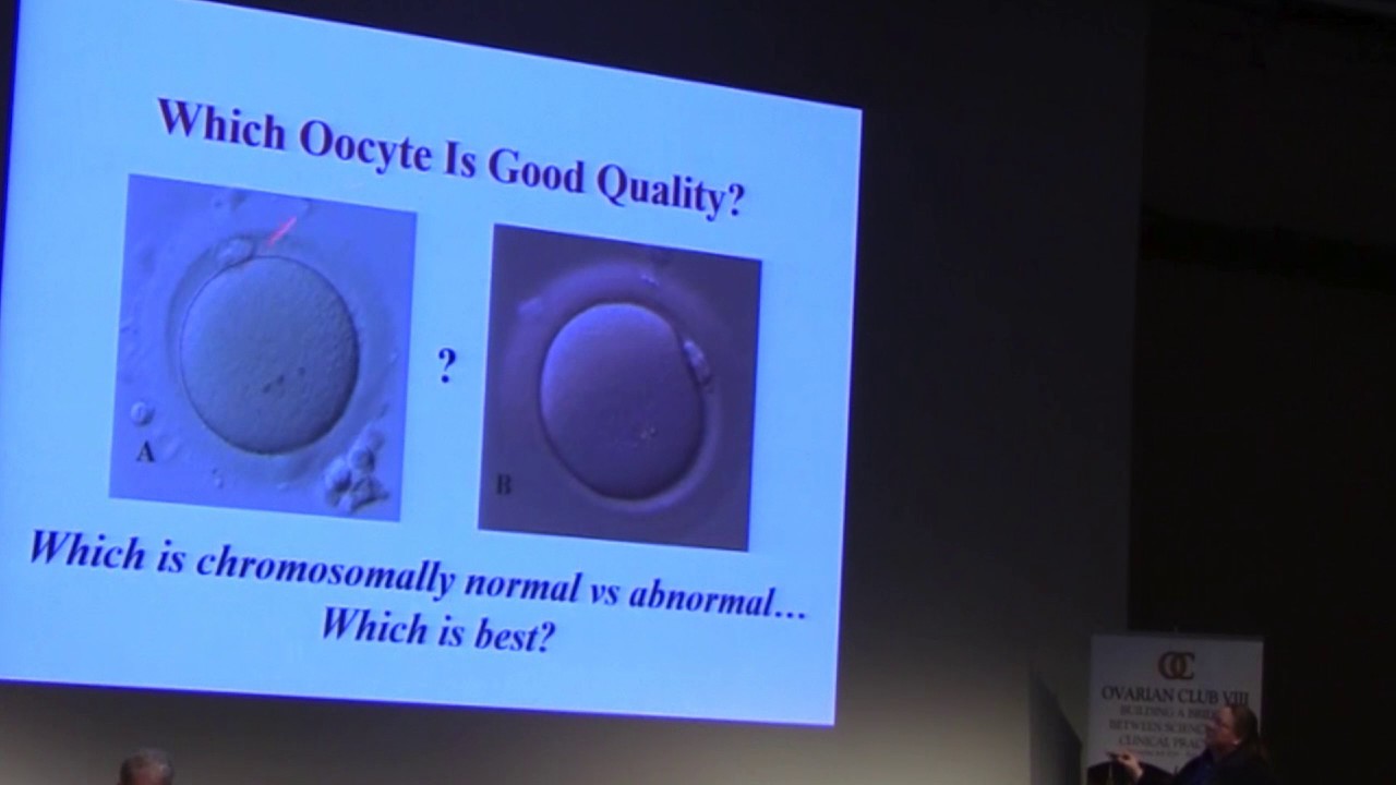 Indices of human oocyte development in health, age and infertility ...