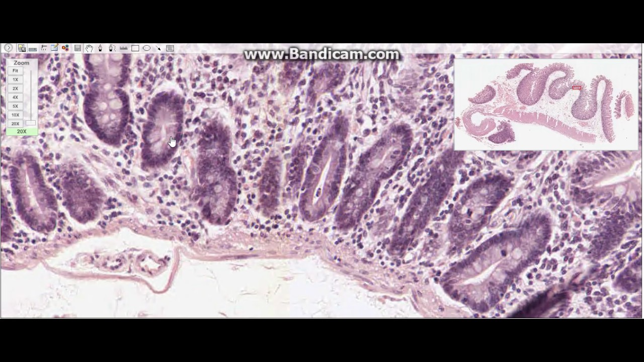 Histology Of The Small intestine - YouTube