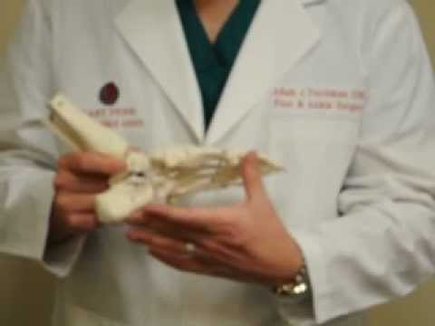 Dr Teichman Talks Plantar Fasciitis - YouTube