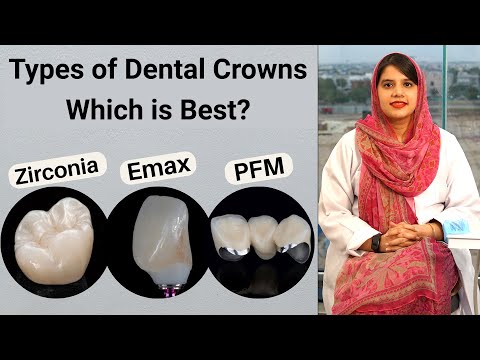 Dental Crown Types & Cost in Pakistan | Zirconia, PFM, Metal, E-max | Which One is Best