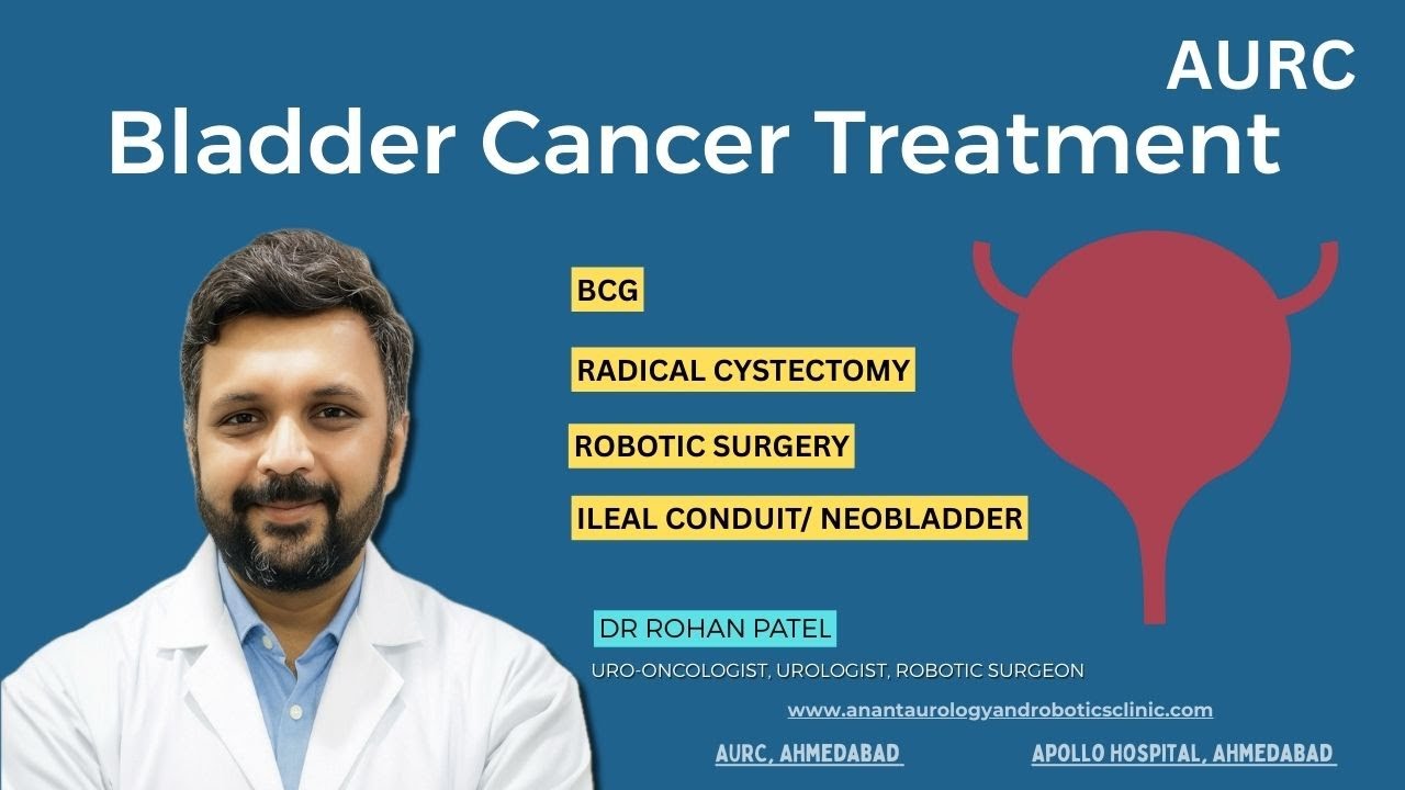Bladder Cancer Treatment Explained | BCG, Robotic Cystectomy ...