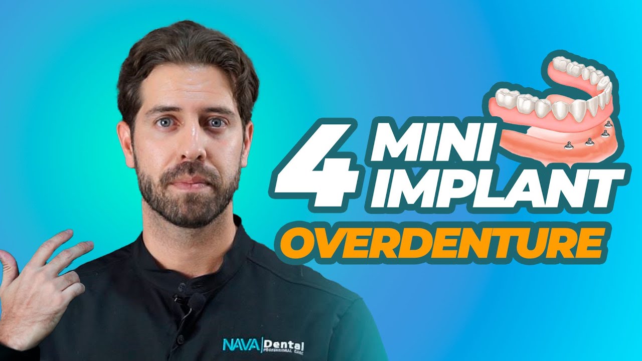 Nava Dental - Four Mini Implant Overdenture - YouTube