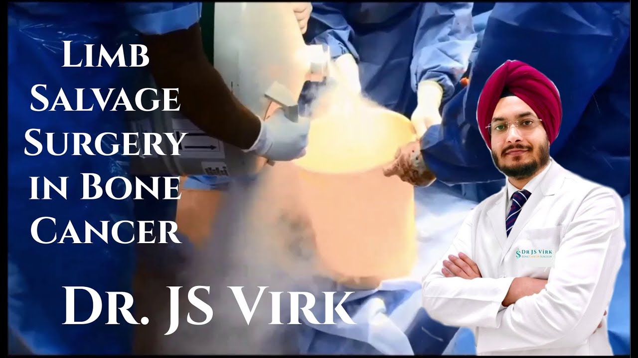Limb Salvage Surgery in Bone Cancer Patients by Dr JS Virk - YouTube