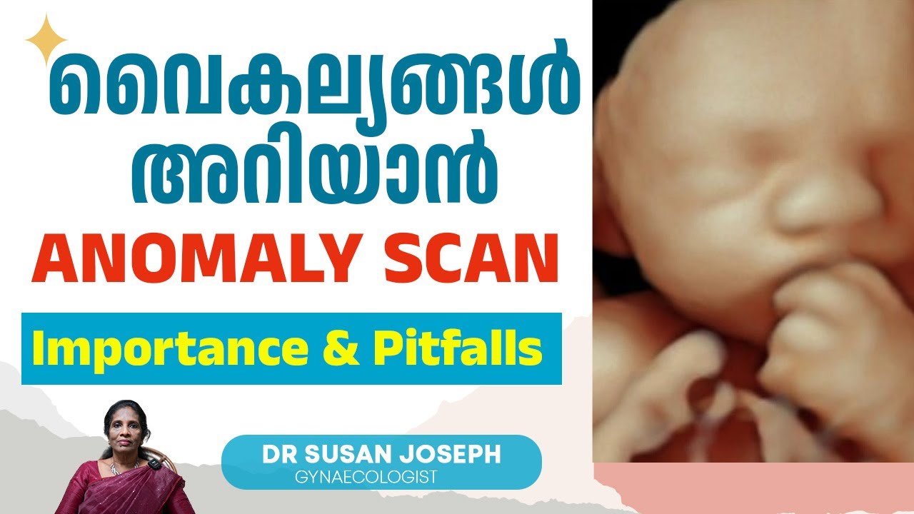 വൈകല്യങ്ങൾ 100% അറിയാൻ പറ്റുമോ അനോമലി സ്കാനിൽ? | DR.SUSAN JOSEPH - YouTube