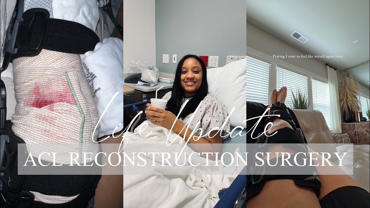 Life After ACL Reconstruction Surgery: Weeks 1-4 Update & Progress ...