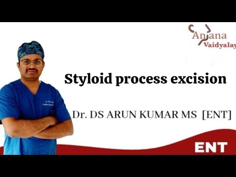Styloid process Excision @GA - YouTube