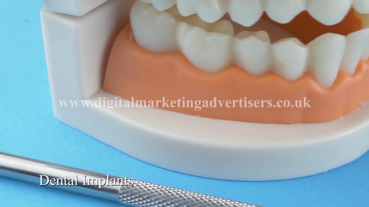 Our Dental Project - YouTube