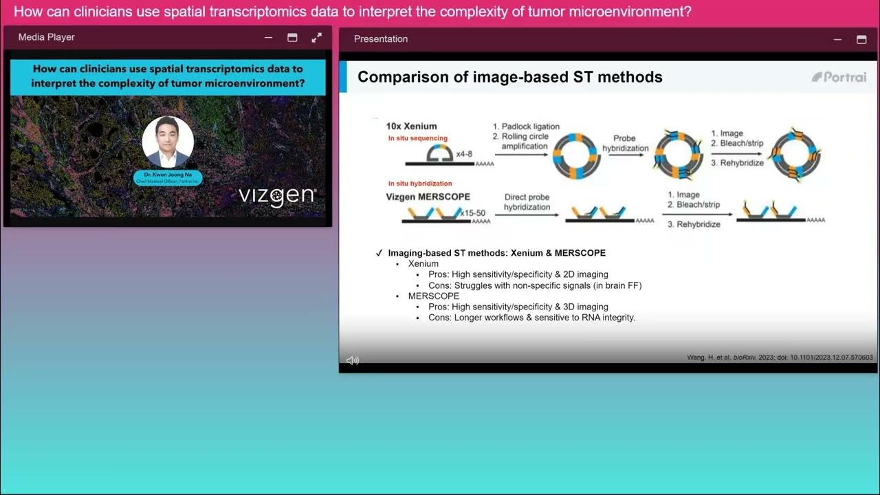 How clinicians use spatial transcriptomics to interpret the complexity of tumor microenvironment ...
