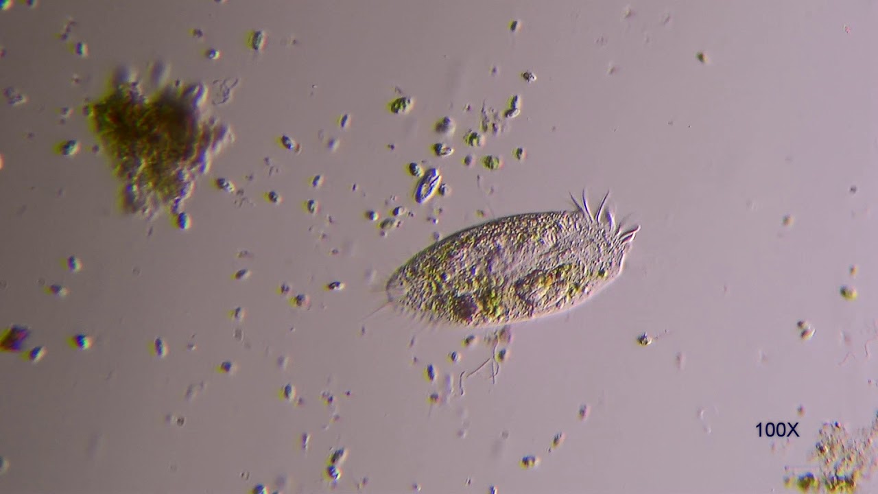 Ciliates Under Microscope