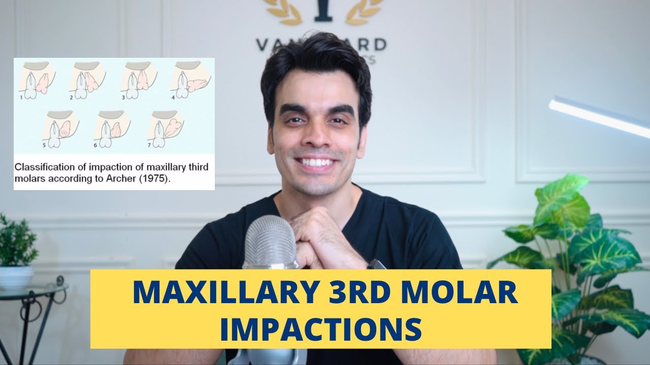 Maxillary Third Molar Impactions YouTube maxillary-third-molar-impactions-youtube