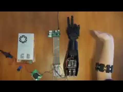3D_Printed_Controllable_Prosthetic_Hand_via_EMG - YouTube