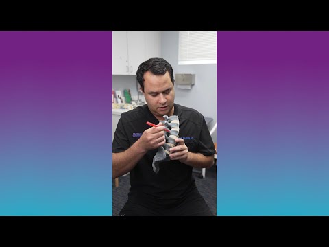 What is a Cervical Epidural Injections Explained by Dr. Anthony Giuffrida