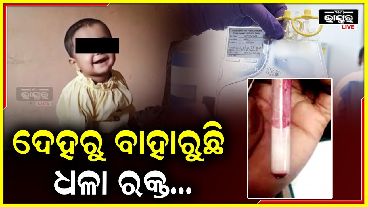 ଏହି କୁନି ଶିଶୁଙ୍କ ଦେହରେ ନାଲି ରକ୍ତ ନୁହେଁ ବହୁଛି ଧଳା ରକ୍ତ - YouTube