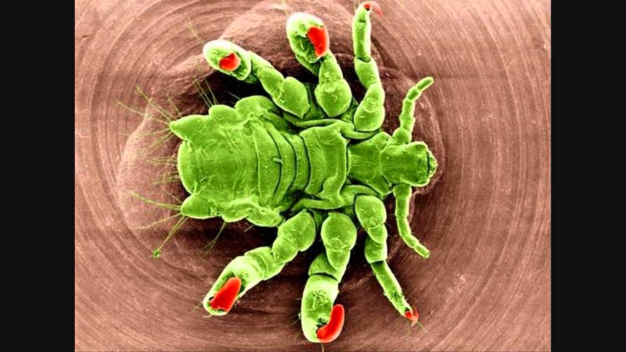 La cancion de la ladilla - YouTube