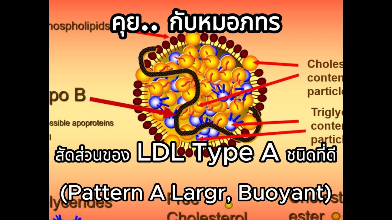 คุยกับหมอภทร ตอน สัดส่วนของ LDL Type A ชนิดที่ดี (Pattern A Largr ...